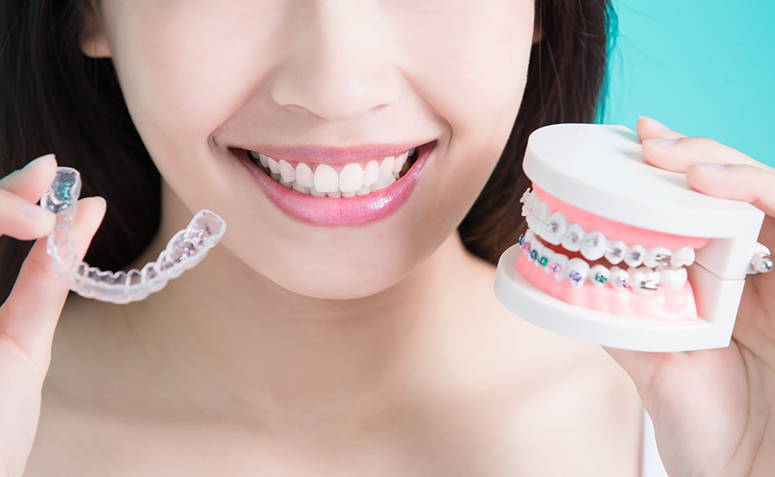 CONHEÇA OS TIPOS DE APARELHOS MAIS INDICADOS PELOS ESPECIALISTAS ...